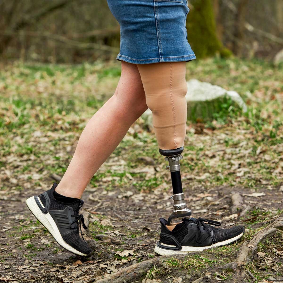 Prosthetics | Allard International